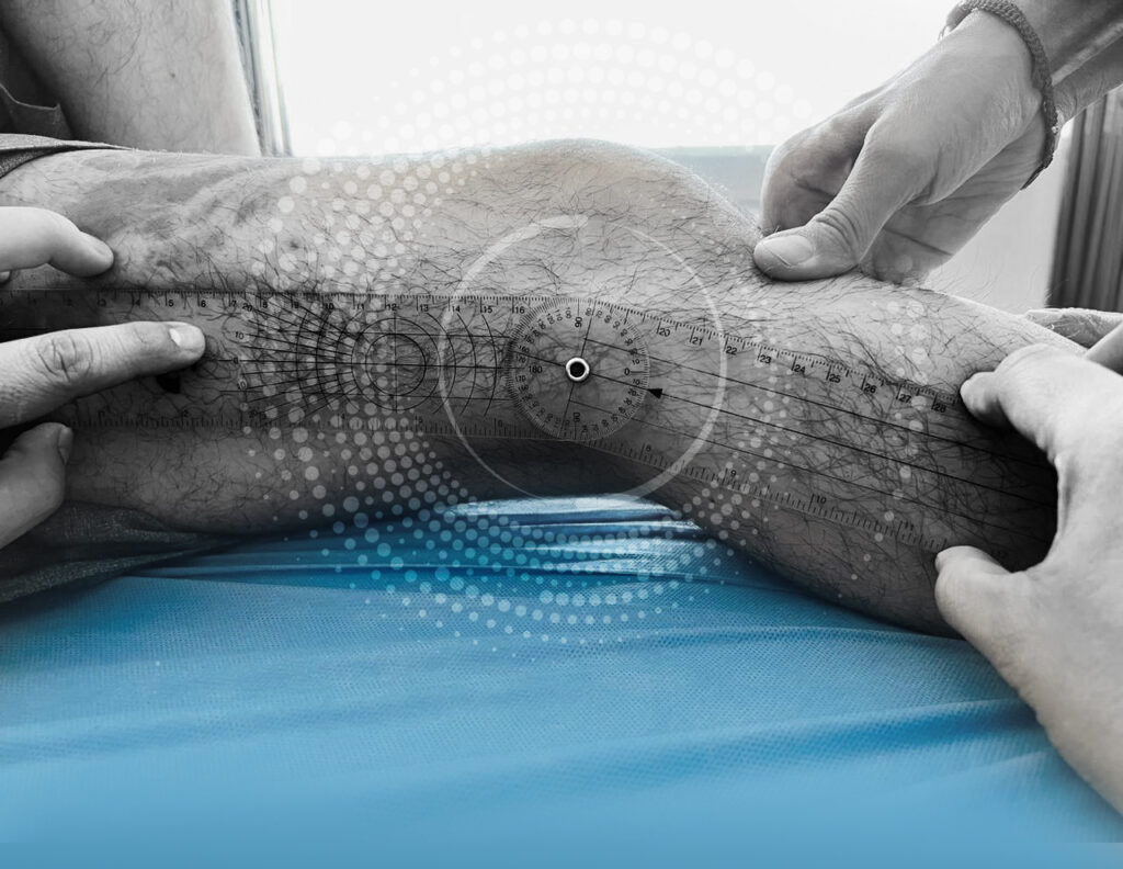 ARTROFIBROSIS Y FISIOTERAPIA | DM Clinic